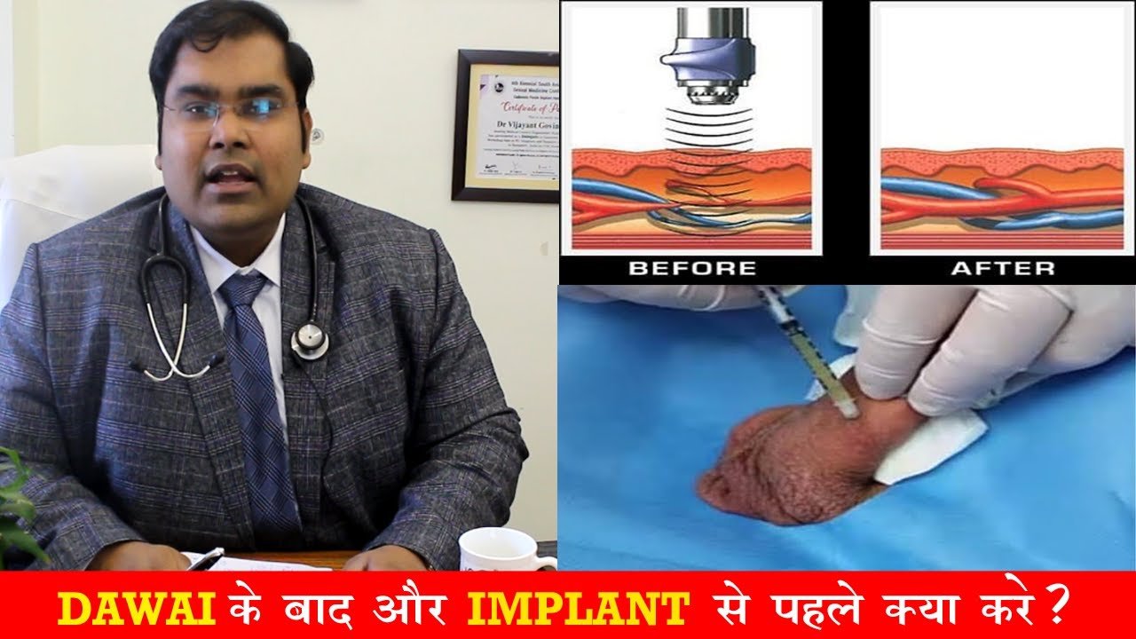 Shockwave Therapy for Erectile Dysfunction in Delhi - New Delhi ...