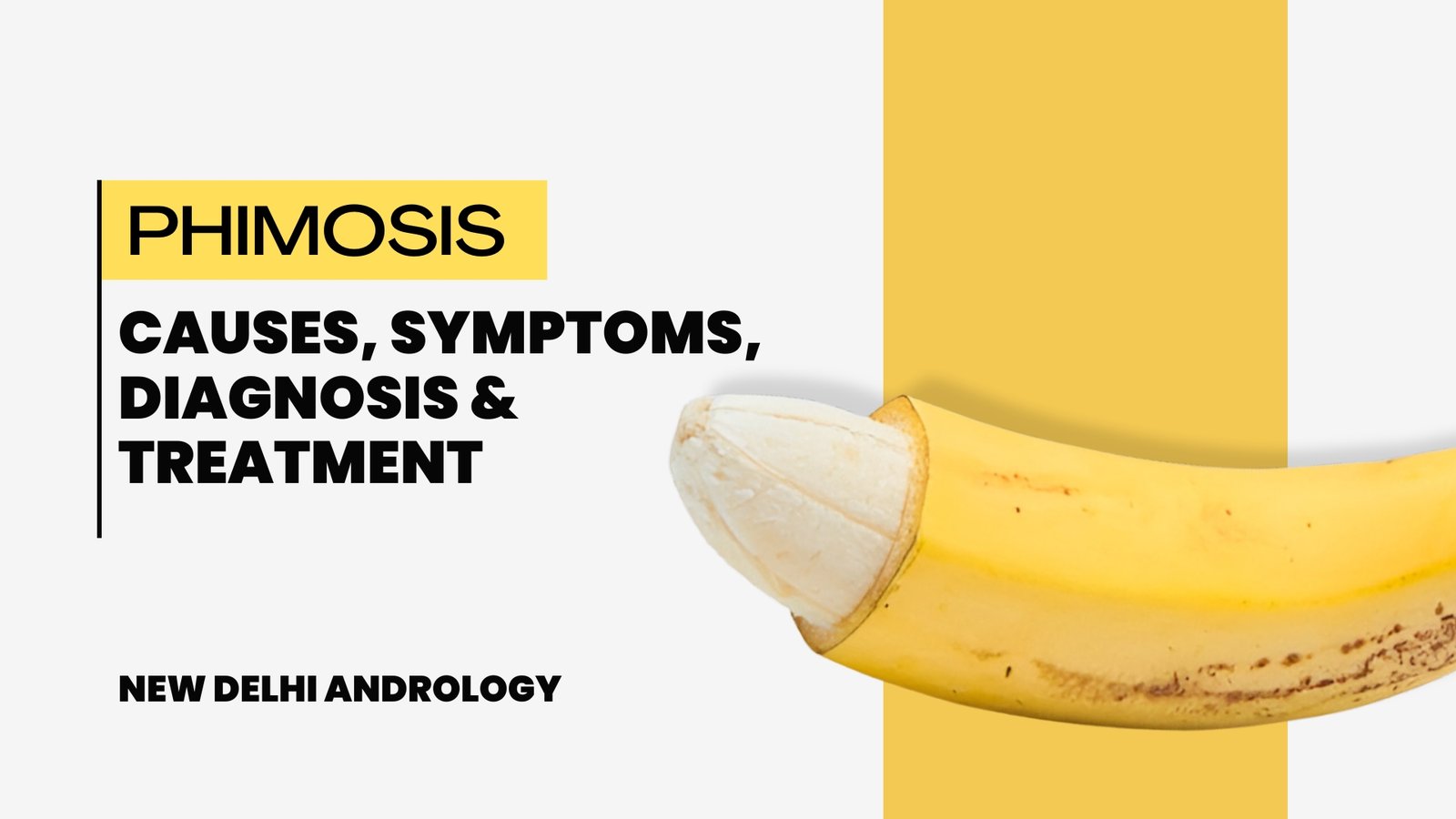 Phimosis: Causes, Symptoms, Diagnosis & Treatment